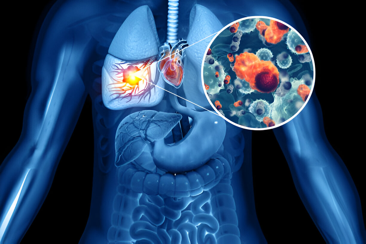 What is Spirometry? How It Helps with Asthma | Primary Care Physician ...